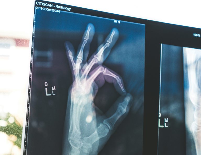 Children and Consent to Medical Procedures - Elringtons Lawyers